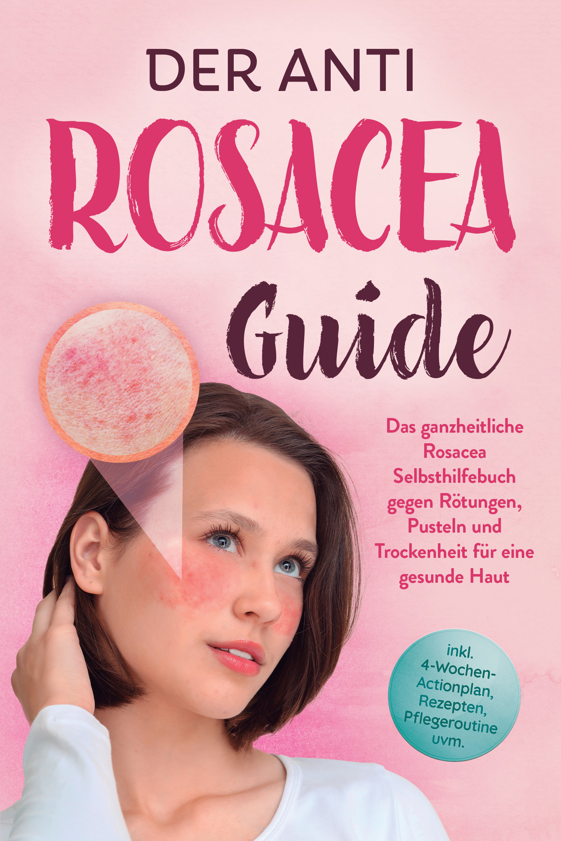 Der Anti Rosacea Guide: Das ganzheitliche Rosacea Selbsthilfebuch gegen ...