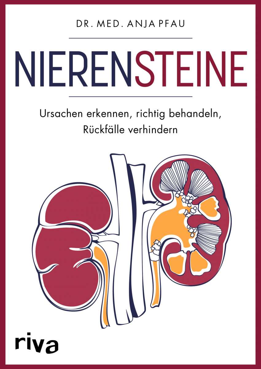 Nierensteine – Ursachen erkennen, richtig behandeln, Rückfälle ...